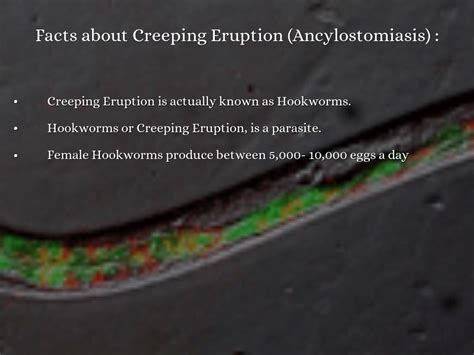 Creeping Eruption Ancylostomiasis By Allie Waston