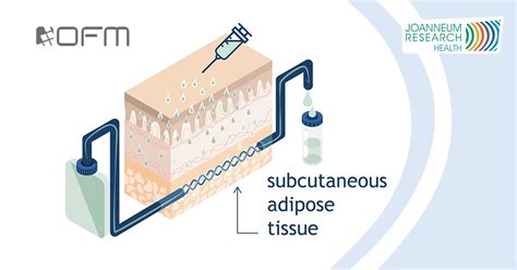 Subcutaneous Drug Development And Delivery Consortium On Linkedin