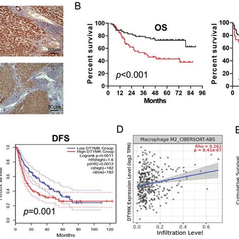 Increased Expression Of Dtymk In Hcc A Gene Analysis Of Patients With Download Scientific