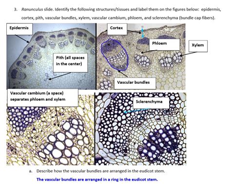 Xylem Sclerenchyma