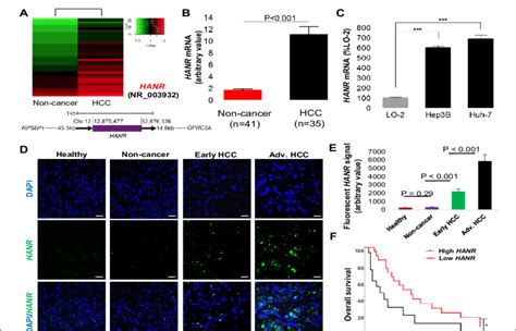 Up Regulated Hanr Expression In Hcc A Microarray Analysis Was