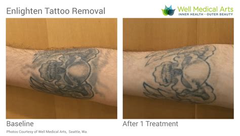 Master Tattoo Before And After Care For Lasting Results