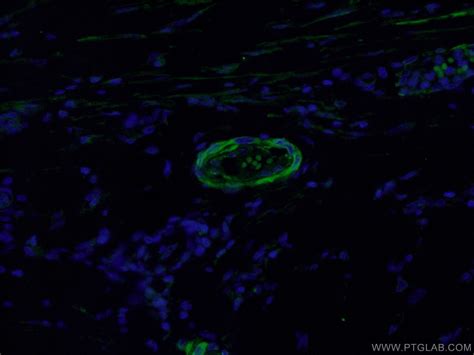 Dll4 Antibody 21584 1 Ap Proteintech