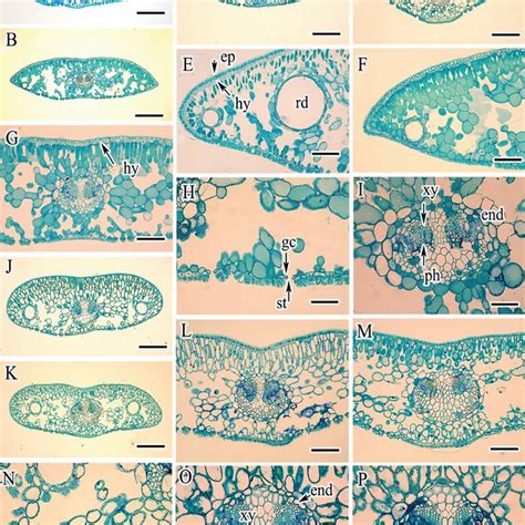 Pdf Comparative Leaf Anatomy Of Some Abies And Picea Pinaceae Species