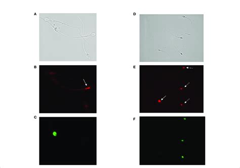 Fluorescence Microscopy Lab Report At Michelle Baldwin Blog