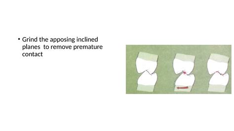 Selective Grinding For Occlusion Adjustment Pptx Pptx