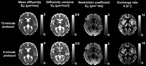 Figure 10 From Diffusion Mri With Free Gradient Waveforms On A High