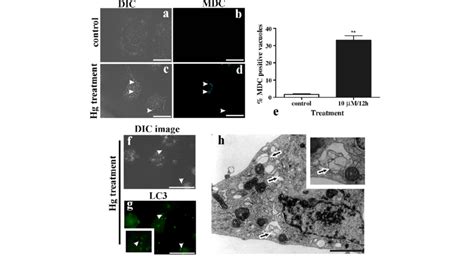 A Control Adherent Cells B Absence Of Mdc Staining In Control