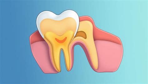 Dentin Hypersensitivity New Insights And Treatment