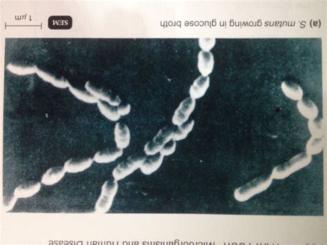 Streptococcus Mutans Agall1995