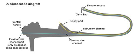 Duodenoscope What Is A Duodenoscope And How Does It Work