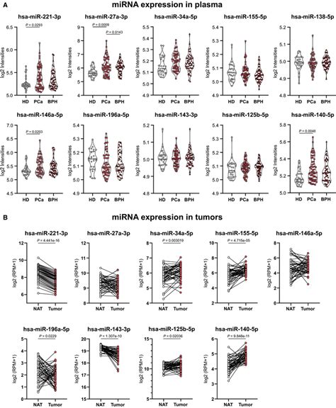 Differential Mirna Expression In Tumor Tissue And Circulation Of Pca