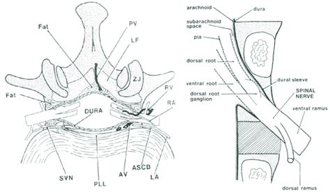 The Nerve Roots Are Enclosed In Their Dural Sleeve Which Is Surrounded Download Scientific