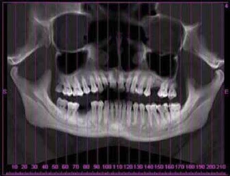 Panoramic View Of Ct Download Scientific Diagram