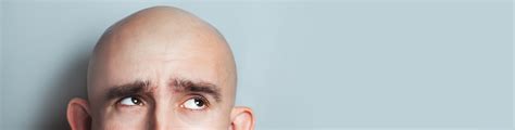 Male Balding Genetics Where Does The Balding Gene” Come From Strut Blog