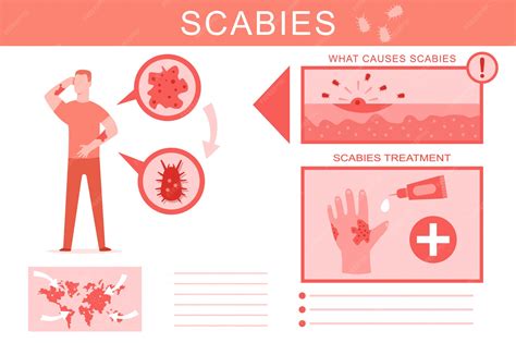 Premium Vector Scabies Causes And Treatment Medical Infographics
