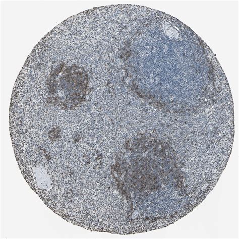 Tissue Expression Of Cd79b Staining In Spleen The Human Protein Atlas