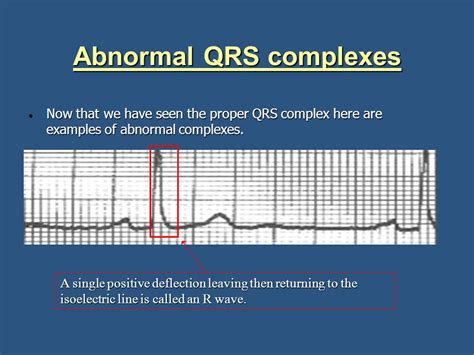 Cardiac Monitoring Ppt Download