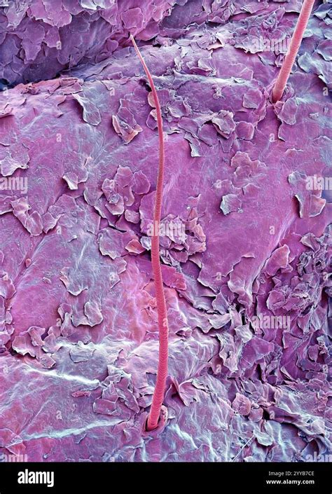 Lèvre Humaine Micrographie électronique à Balayage Coloré Meb Dune