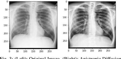 Figure 3 From An Explainable Ai Model For Interpretable Lung Disease