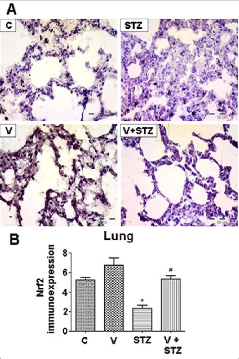 A A Photomicrograph Of Lung Nrf2 Expression B Scoring Of Nrf2