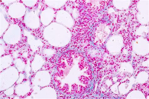 Ffpe Lung Tissue Samples Superior Biodiagnostics