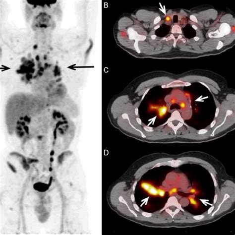 Abass Alavi Professor Of Radiology And Neurology Director Of