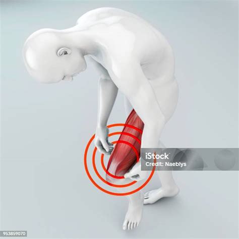 Otot Robek Otot Paha Di Atas Lutut Nyeri Di Kaki Dan Ligamen Foto Stok