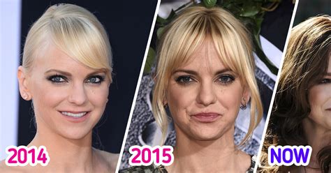 Anna Faris Plastische Chirurgie