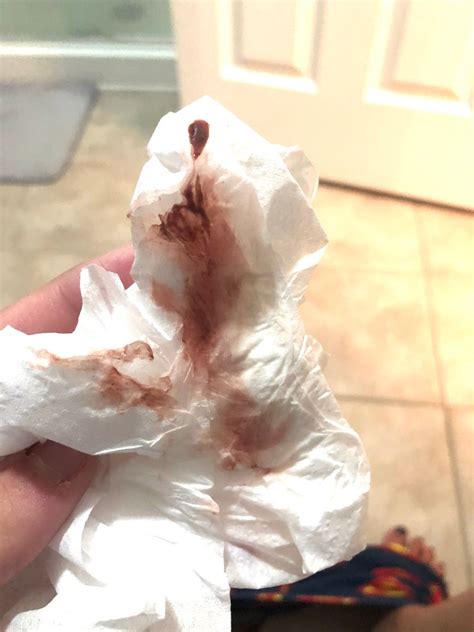 How Does A Miscarriage Look Like At 5 Weeks