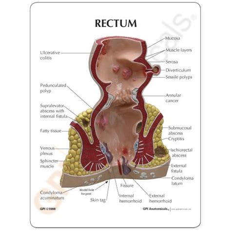 Anatomical Model Rectum
