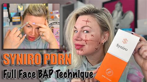 Syniro Pdrn Full Face Bap Technique In Detail Acecosm Code Jessica10 Saves You Money