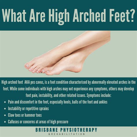 High Arch Feet Causes Symptoms And Treatment Brisbane Physiotherapy