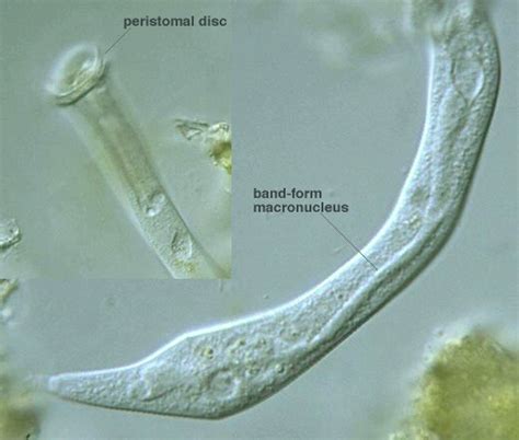 Protist Images Ophrydium Versatile