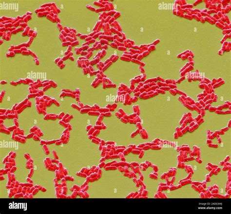 Salmonella Typhi Coloured Scanning Electron Micrograph Sem Of