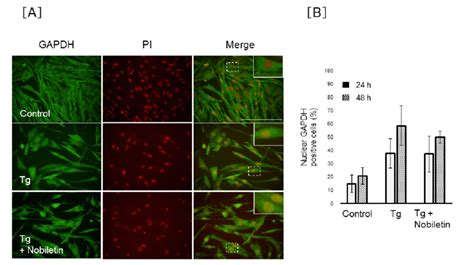 Effect Of Nobiletin On Thapsigargin Induced Nuclear Translocation Of