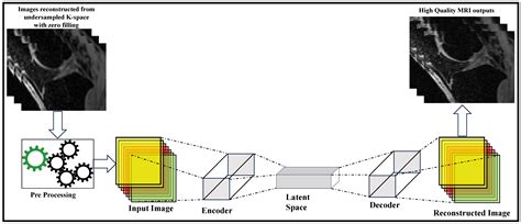 Deep Learning Based Mri Reconstruction With Transformer Jrrjs