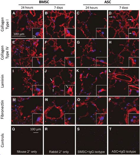 Ecm Ihc In 3d Slice Cultures Demonstrates The Initial Binding
