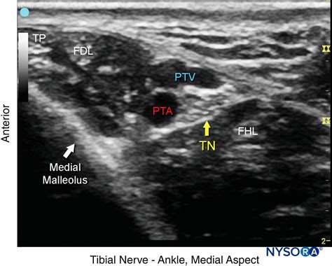 Posterior Tibial Nerve And Sural Nerve Block — Kwak Talk
