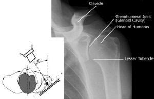 Ce4rt Radiographic Positioning Of The Shoulder For X Ray Techs