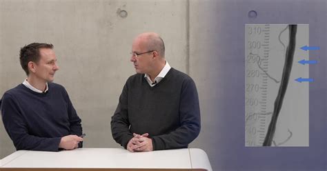 Post Pta Dissection Treatment With Tack Endovascular System How And