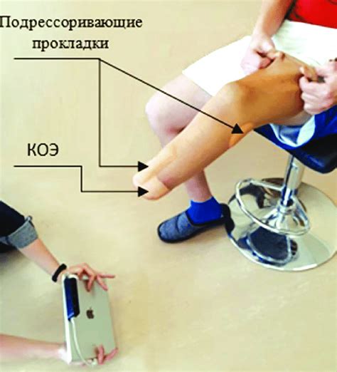 Positioning Of The Stump Before Scanning Download Scientific Diagram