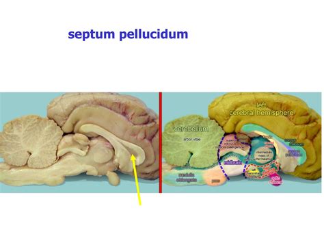 Ppt Brain Anatomy Tutorial The Tree Of Life In Cerebellum And