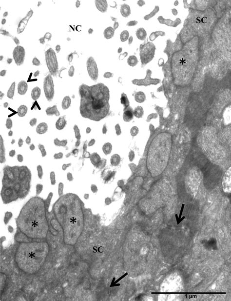 Apical Part Of Olfactory Neuroepithelium In Pseudapocryptes Lanceolatus Download Scientific