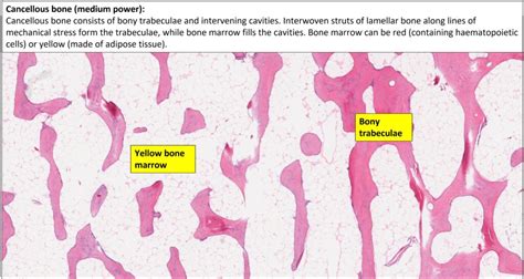 Bone Normal Histology Nus Pathweb Nus Pathweb