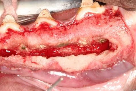 Photograph Taken During Surgery Note Uniform Dimensions Of Bone Trough