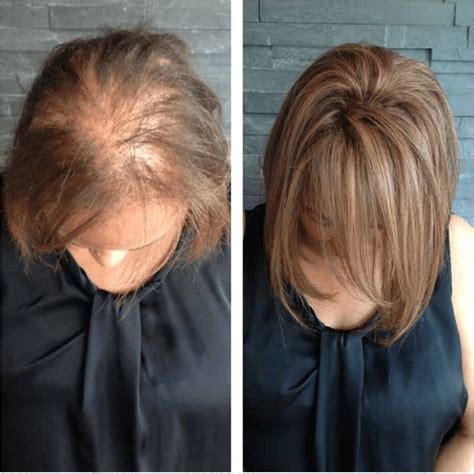 Breathtaking Photos Of Hairstyles For Thinning Hair In Front Female