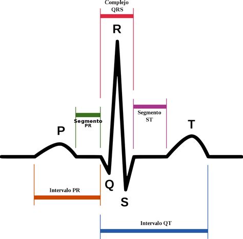 Intervalo Qt Wikipedia La Enciclopedia Libre Normal Ecg Ekg