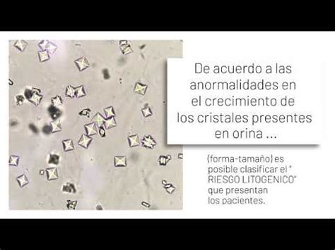 Sabias Que Cristales Presentes En La Orina Youtube