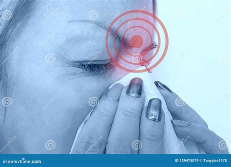 Woman Sinusitis Unhealthy Symptom Allergies Stock Image Image Of Migraine Average 139475079
